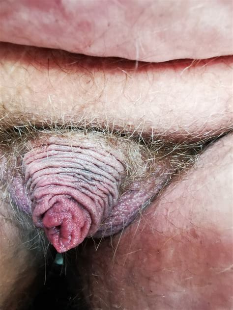 Worlds Smallest Dick 4 Pics Xhamster