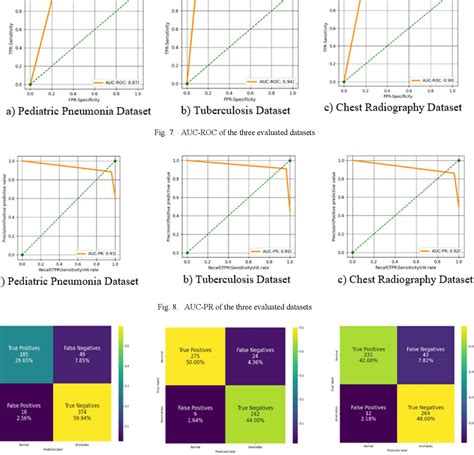 Figure 8 From Unsupervised Lung Anomaly Detection From Chest