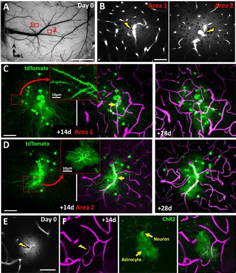 Targeted Delivery Of Aavs And Sparse Expression Of Cre Recombinase