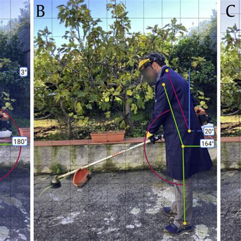 Digital Postural Analysis In Frontal A Posterior B And Sagittal Download Scientific