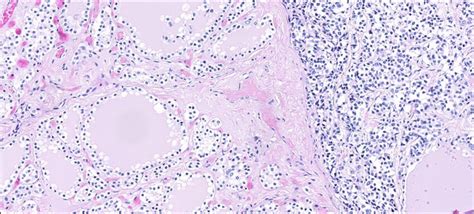 Small Cells With Slight Cytoplasm Round Nuclei And Small Punctate Download Scientific Diagram