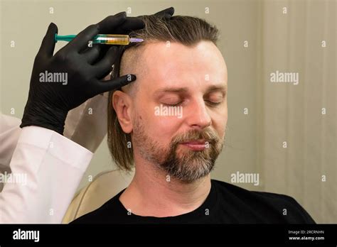 Сosmetologist uses thin needle to inject Platelet Rich Plasma in scalp PRP therapy and plasma