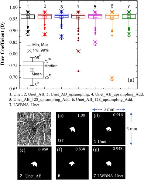 a boxplot of dice coefficient d on a testing dataset of 145 images