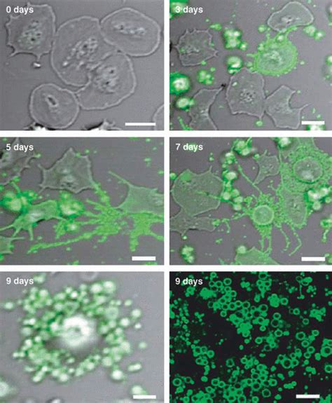 Confocal Microscopy Of Platelets Staining Using Fluorescein