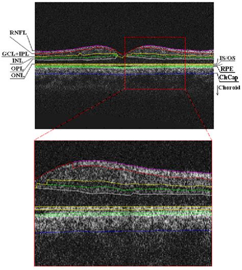 automated and semi automated segmentation results the boundaries