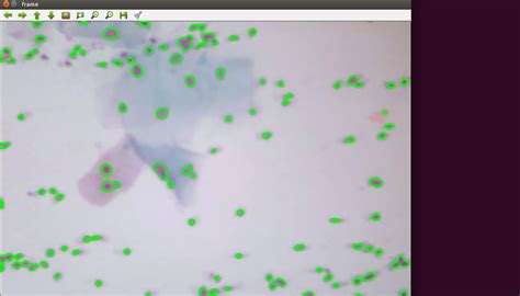 Cell Segmentation CVI