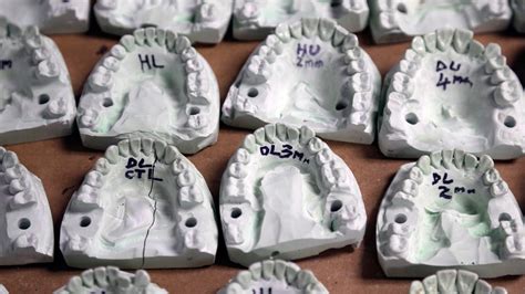 Texas Case Calls Bite Mark Evidence Into Question