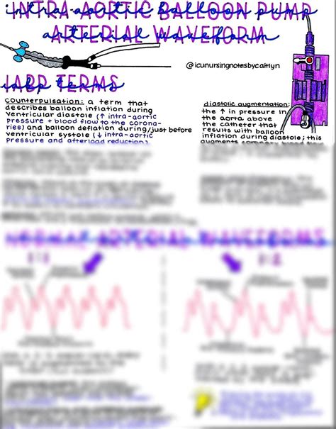 A 2 Page Nursing Cheat Sheet For Intra Aortic Balloon Pump Iabp