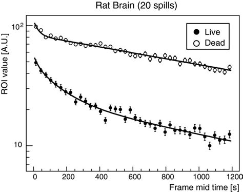 Time Activity Curves Tacs With Fit Results For The Live Scan The