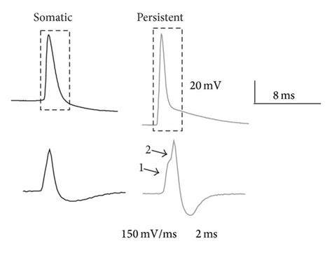 Layer 1 Interneurons Displayed Spontaneous Ectopic Action Potentials