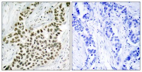 Histone Antibodies And Elisa Kits