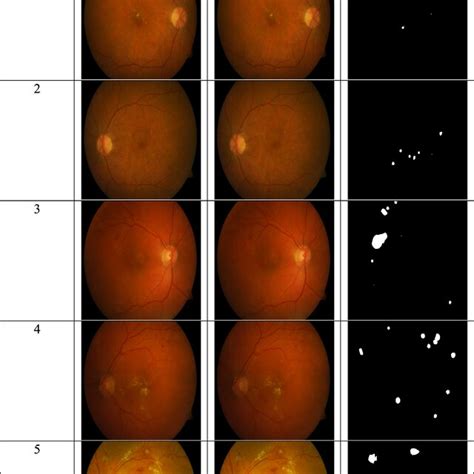 Confusion Matrix Using The S Ddl Algorithm On The Octid Dataset For