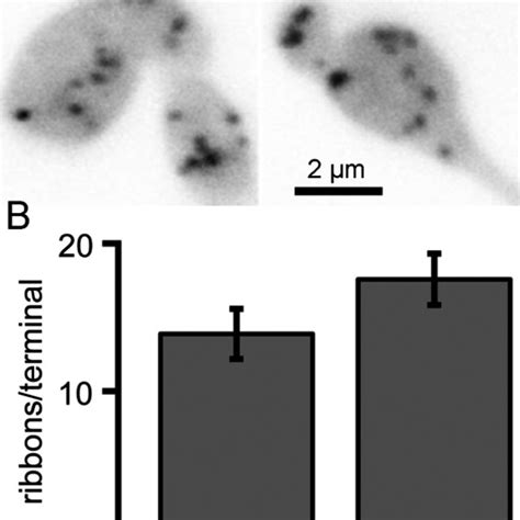 C Terminal Binding Protein 2 Ctbp2 Immunostaining At Ribbons Is Download Scientific Diagram