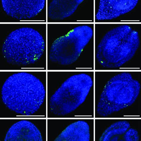 The Oncosphere To Metacestode Metamorphosis In Different Tapeworms A