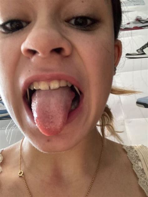 Audio 230410173318 By MinorTriangleTransmission57645