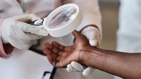 Targeting Gpp A Guide For Physicians On Diagnosis Burden Management