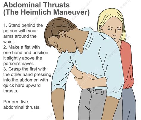 Heimlich Maneuver Instructions
