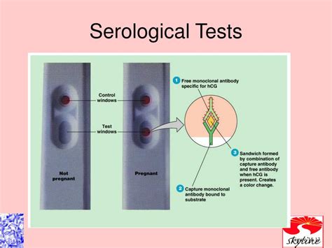 Nursing Mcq39s And Guide Serological Tests
