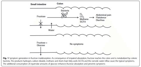 Fructose Malabsorption A Beginners Guide To Treatment