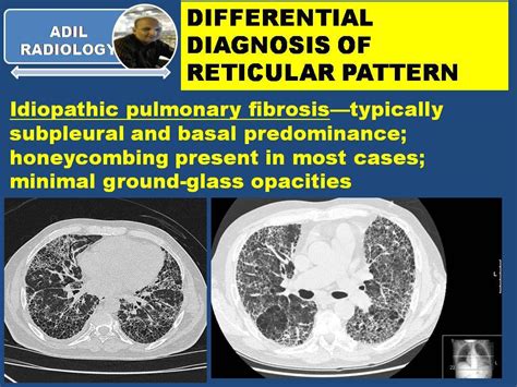 Differential Diagnosis Of Reticular Radiology Classroom