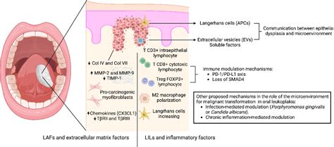 Figure 1 From New Insights Into The Role Of The Oral Leukoplakia