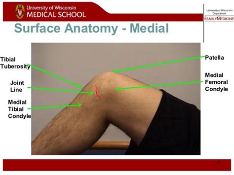 Knee