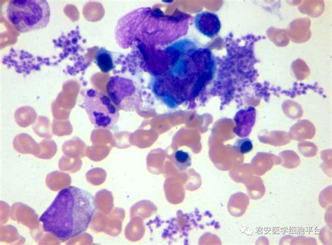 红细胞缗钱状排列居然是因为“他