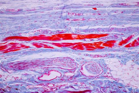 Characteristics Tissue Of Human Scalp Skin Human From General Body