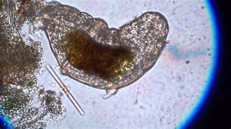 Water Bear Not Under Microscope At Edna Mondragon Blog