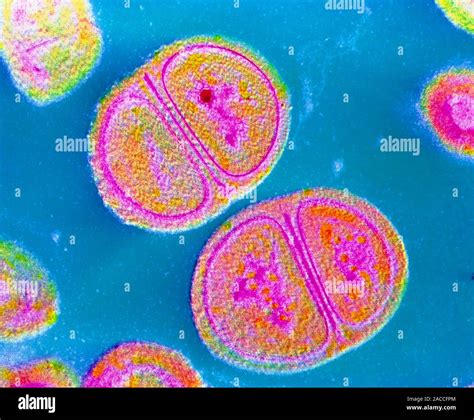 False Colour Transmission Electron Micrograph Tem Of Staphylococcus Epidermidis A Species Of