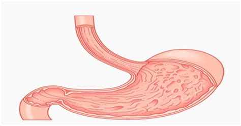 Electrogastrogram Procedure Details