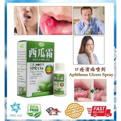 Proice Oral Ulcer Spray Watermelon Mouth Ulcer Soothing Coolness
