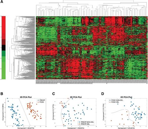 Multivariable Predictive Model Of Postoperative Delirium In Tanvi Khera