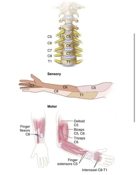 cervical root findings by level hossam magdy posted on the topic