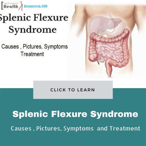 Splenic Flexure Problems