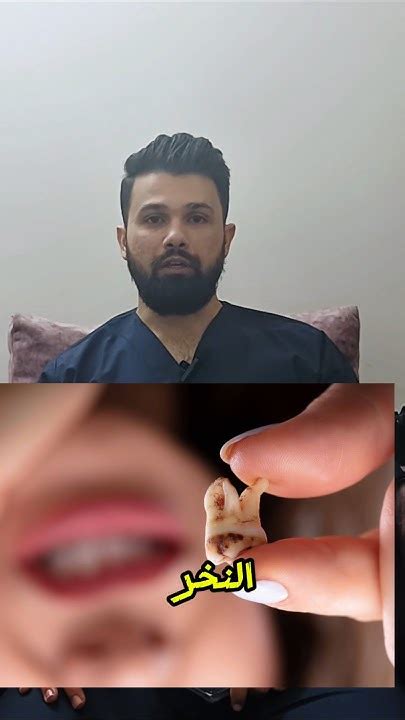 كيف يتكون نخرسني سؤالوجواب طبيدكتور مصعب السياد Reels Dentist