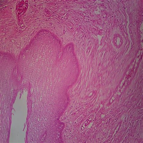 Mammal Bladder Sec 7 µm Hande Microscope Slide Carolina Biological Supply