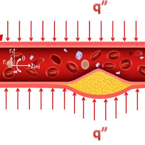 Blood Flow Inside An Artery Download Scientific Diagram