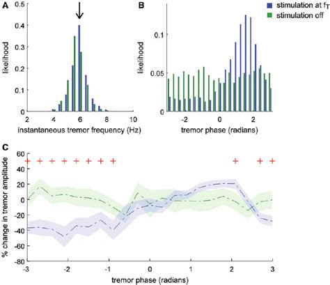 Exemplar Effect Of Dbs On Essential Tremor In Patient 6 Dbs At Near Download Scientific