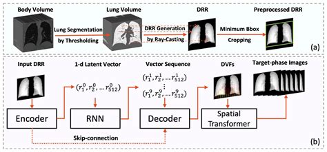 Dynamic Chest Radiograph Simulation Technique With Deep Convolutional Neural Networks A Proof