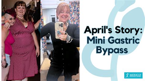 Aprils Amazing Weight Loss Story Mexico Bariatric Center®