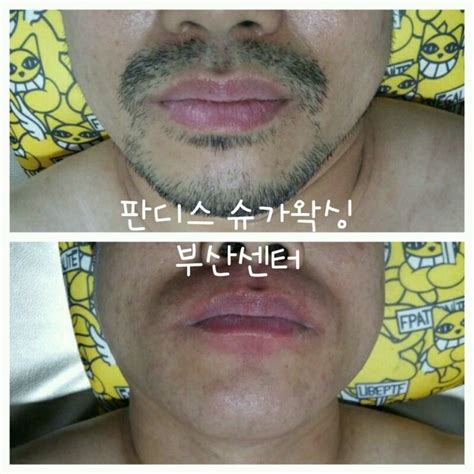 부산 서면 남자왁싱 땀 많이 나는 분 추천 브라질리언왁싱 다리왁싱 턱수염제모 엉덩이왁싱 네이버 블로그