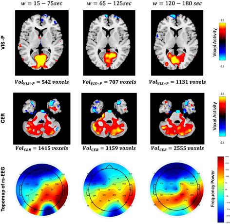 Frontiers Integrating Fmri Spatial Network Dynamics And Eeg Spectral Power Insights Into