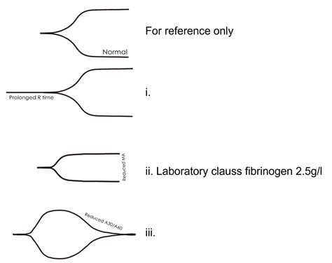 Mcq Emq Questions — Haembase