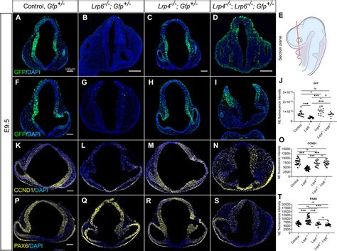Frontiers Balancing WNT Signalling In Early Forebrain Development