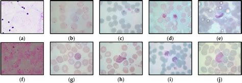 Diagnostics Free Full Text Robust Image Processing Framework For Intelligent Multi Stage