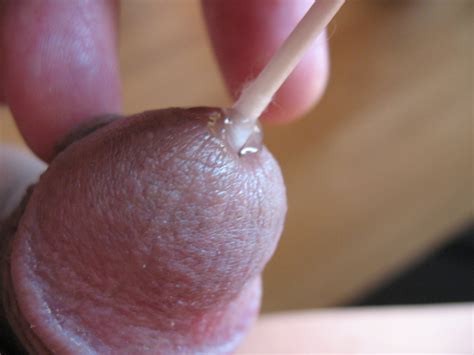 Penis Insertions 23 Pics Xhamster