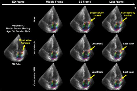 Figure 4 From Continuous 3d Myocardial Motion Tracking Via