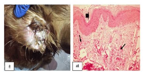 Chronic Otitis Externa Showing 9a Red Inflamed Ear 9 A1