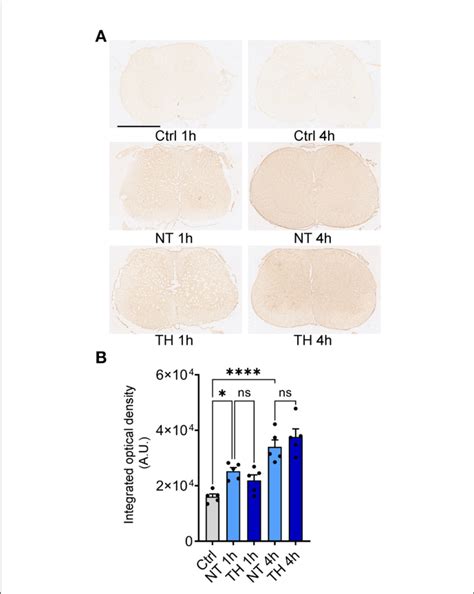 Figure Serum Non Specific Immunoglobin G Igg Leaked Into The Neural Download Scientific